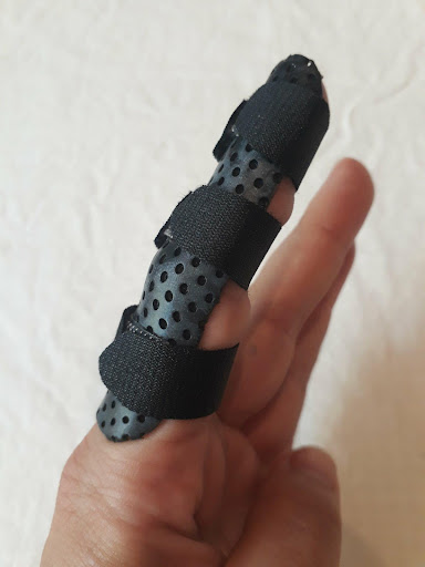 Finger Dislocation Volar Plate Treatment Sydney